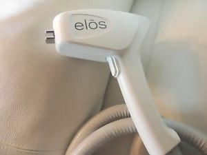 Syneron WRA handpiece | The Laser Professionals